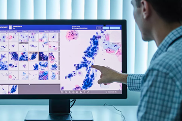 Le Genius Digital Diagnostics System approuvé par la FDA | Hologic® France